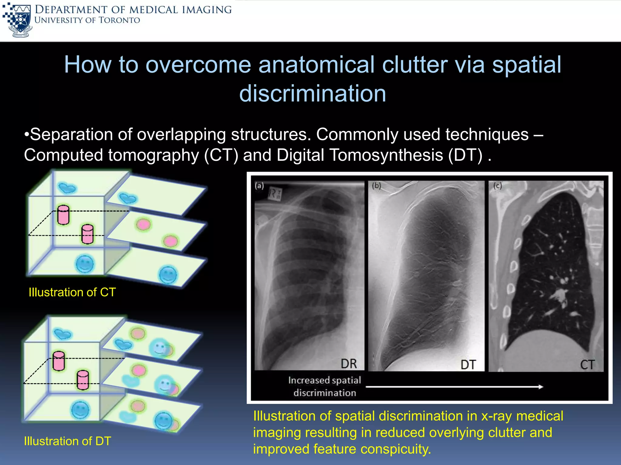 Dual energy imaging and digital tomosynthesis: Innovative X-ray based ...