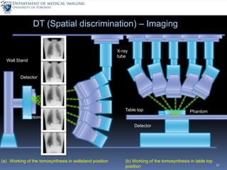 Dual energy imaging and digital tomosynthesis: Innovative X-ray based ...