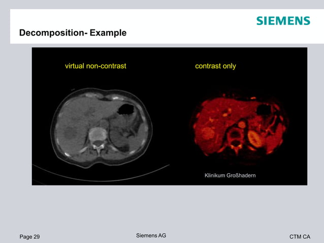 Dual Energy Physik for linear accelerator.ppt