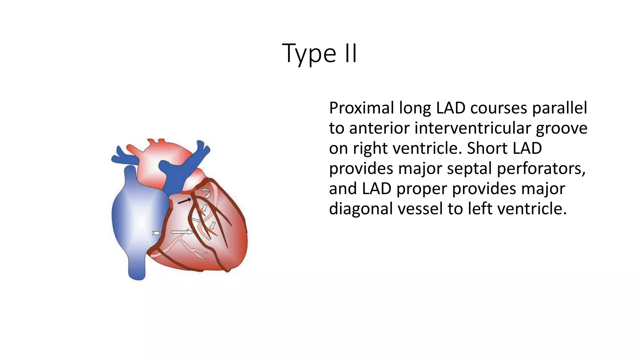 Dual left anterior descending coronary artery | PPTX