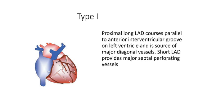 Dual left anterior descending coronary artery | PPT