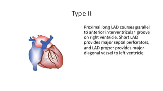 Dual left anterior descending coronary artery | PPT