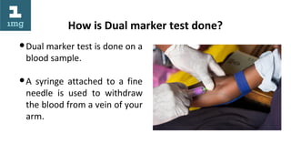 Dual marker test | ODP