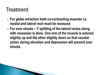 Duane retraction syndrome | PPTX