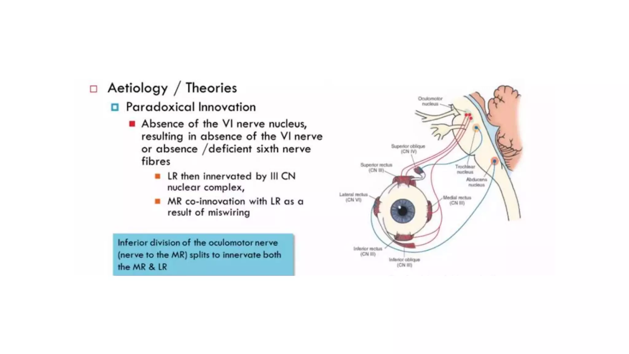 Duane Retraction Syndrome- Congenital Cranial Dysinnervation Disorder ...