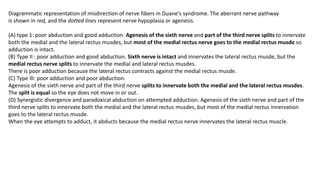 Duane Retraction Syndrome- Congenital Cranial Dysinnervation Disorder ...