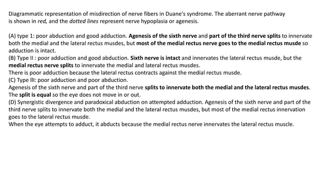 Duane Retraction Syndrome- Congenital Cranial Dysinnervation Disorder ...