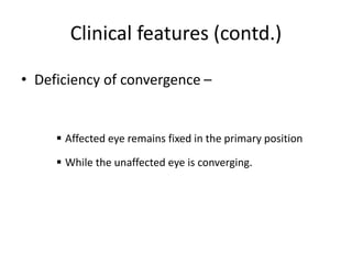 Duane Retraction syndrome.pptx