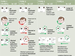 Case Presentation: Duane's Syndrome | PPTX