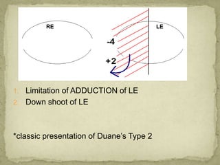 Case Presentation: Duane's Syndrome | PPTX