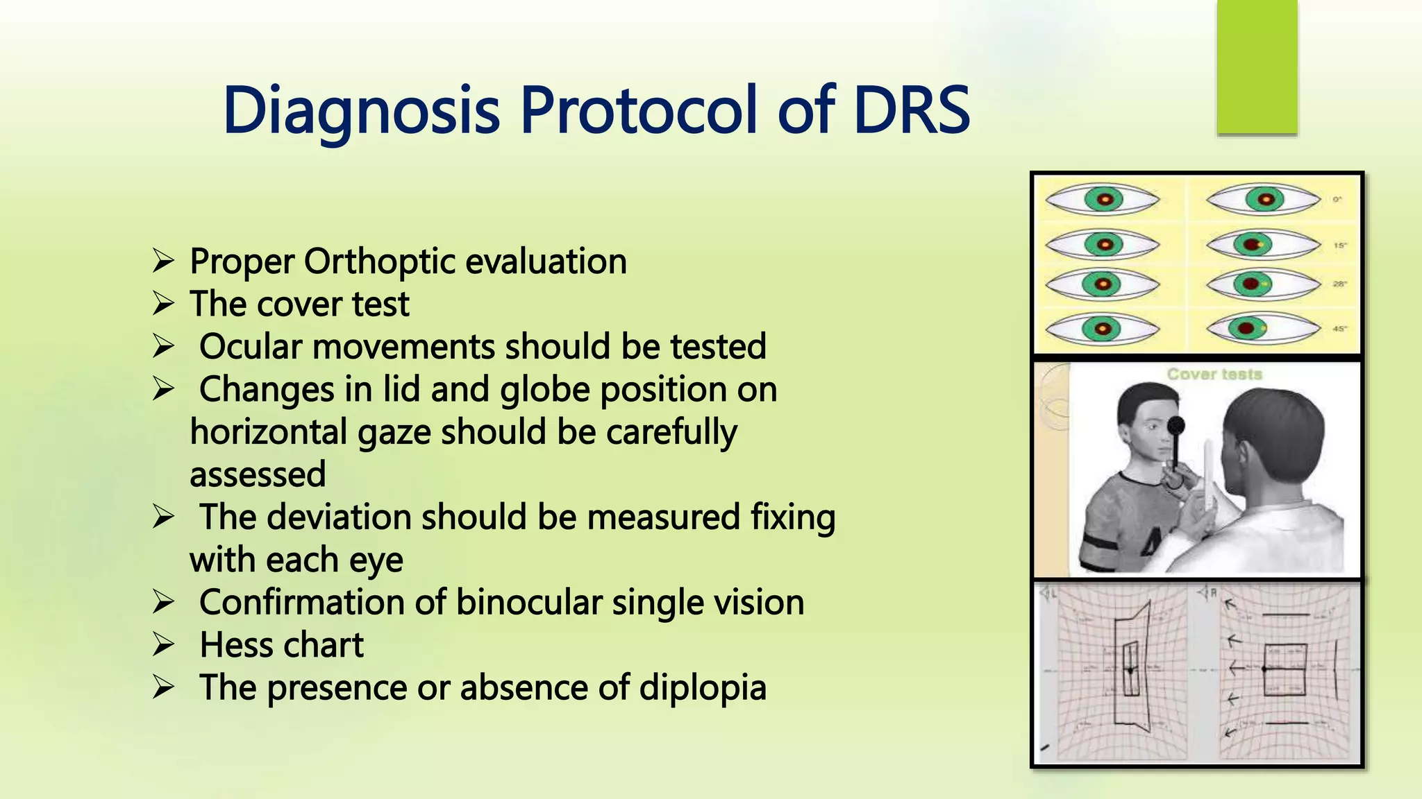 Duane's Retraction Syndrome.pptx