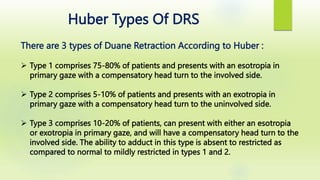 Duane's Retraction Syndrome.pptx | Physical Therapy | Wellness