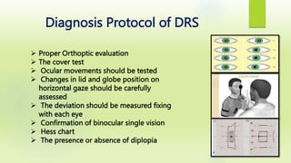 Duane's Retraction Syndrome.pptx