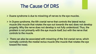 Duane's Retraction Syndrome.pptx