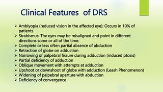 Duane's Retraction Syndrome.pptx