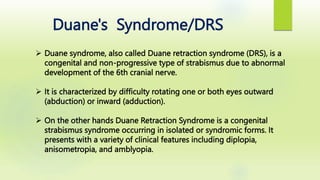 Duane's Retraction Syndrome.pptx