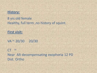 Duane syndrome | PPTX