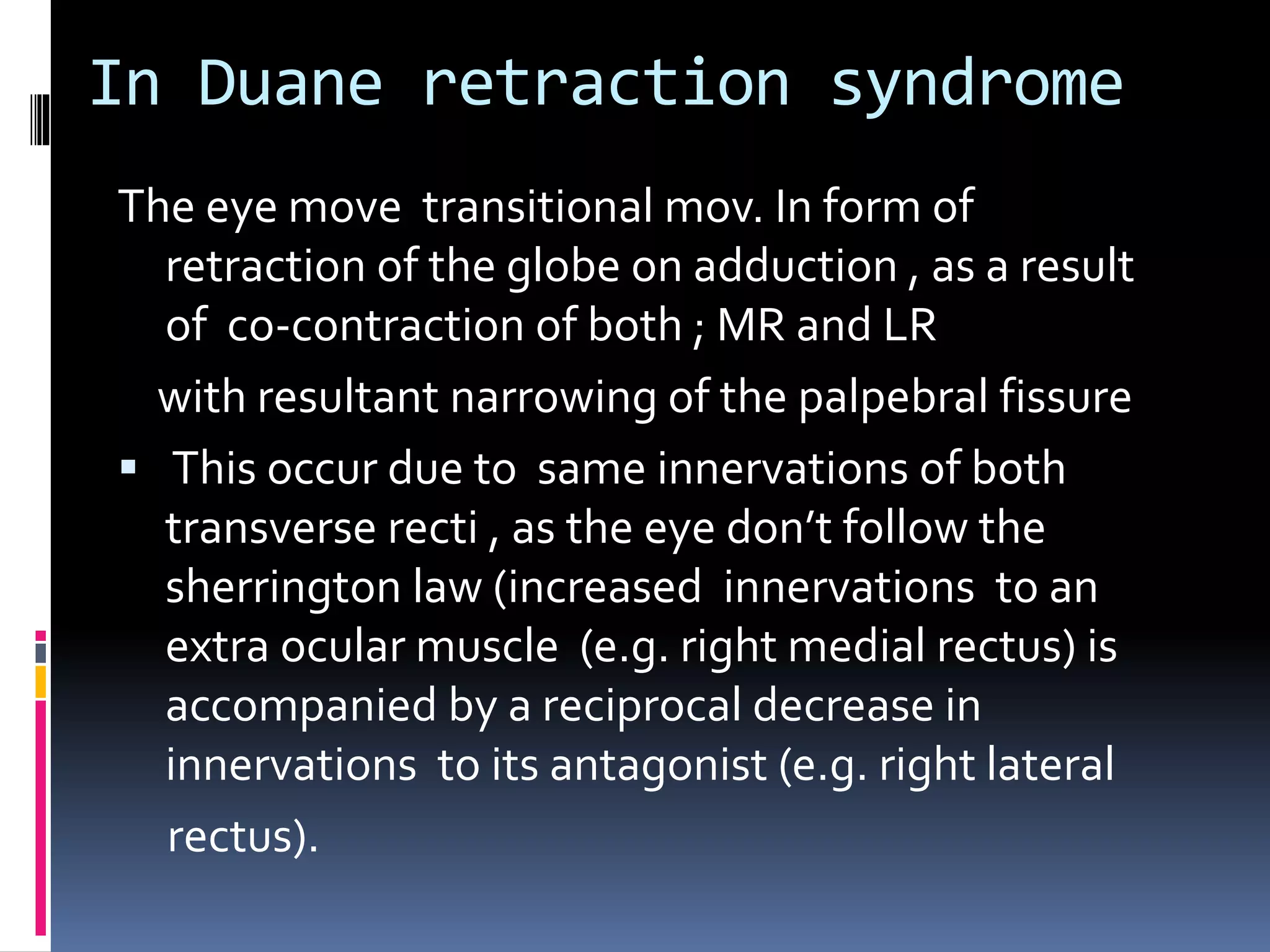 Duane syndrome 2 | PPSX