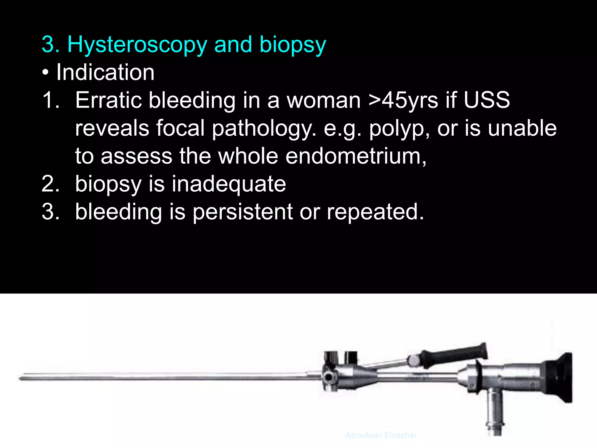 Dysfunctional uterine bleeding | PDF