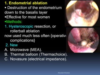 Dysfunctional uterine bleeding | PDF