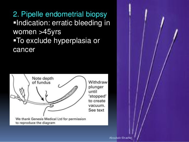 Dysfunctional uterine bleeding