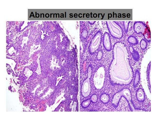 Secretory And Proliferative Phase