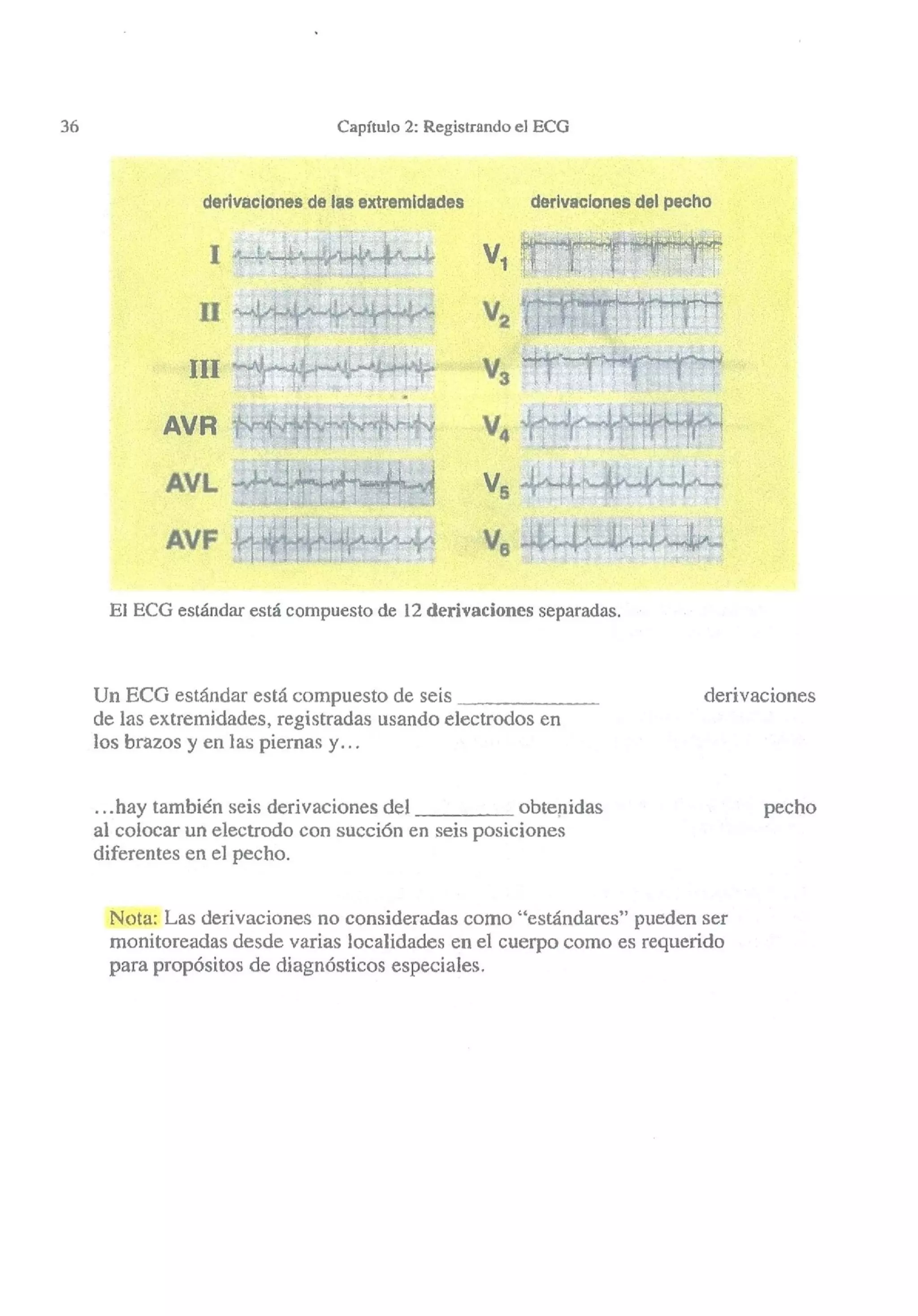 Dubin interpretacion de ECG (1°Edicion Color) | PDF