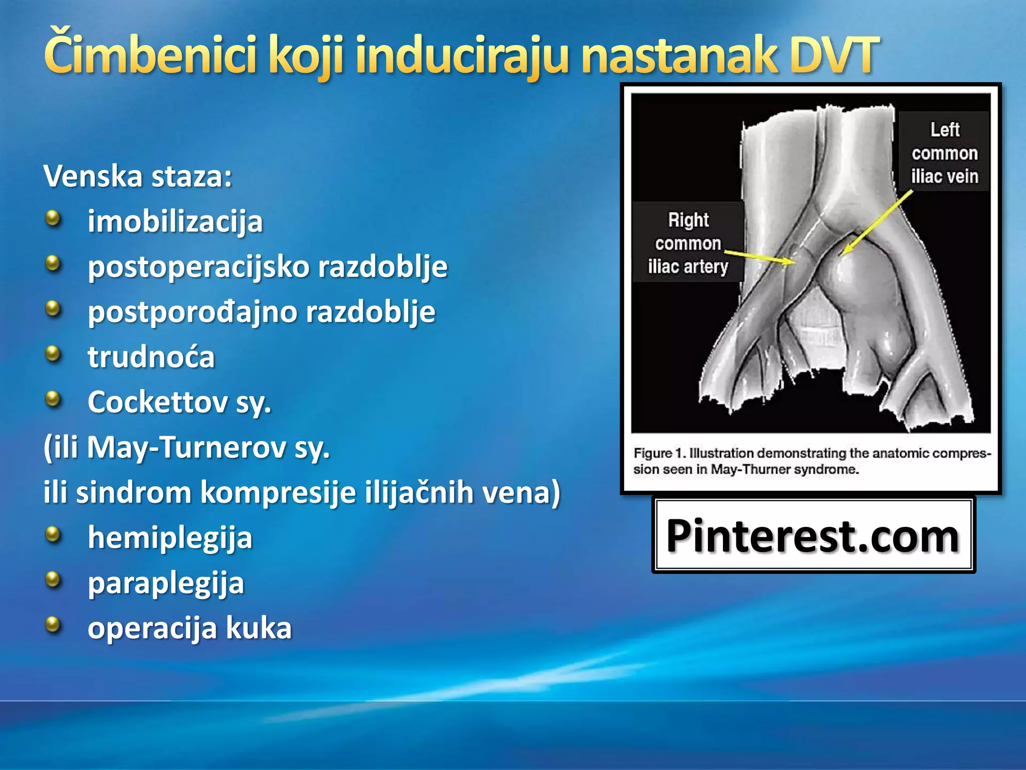 Duboka tromboza vena (dtv) | PPSX