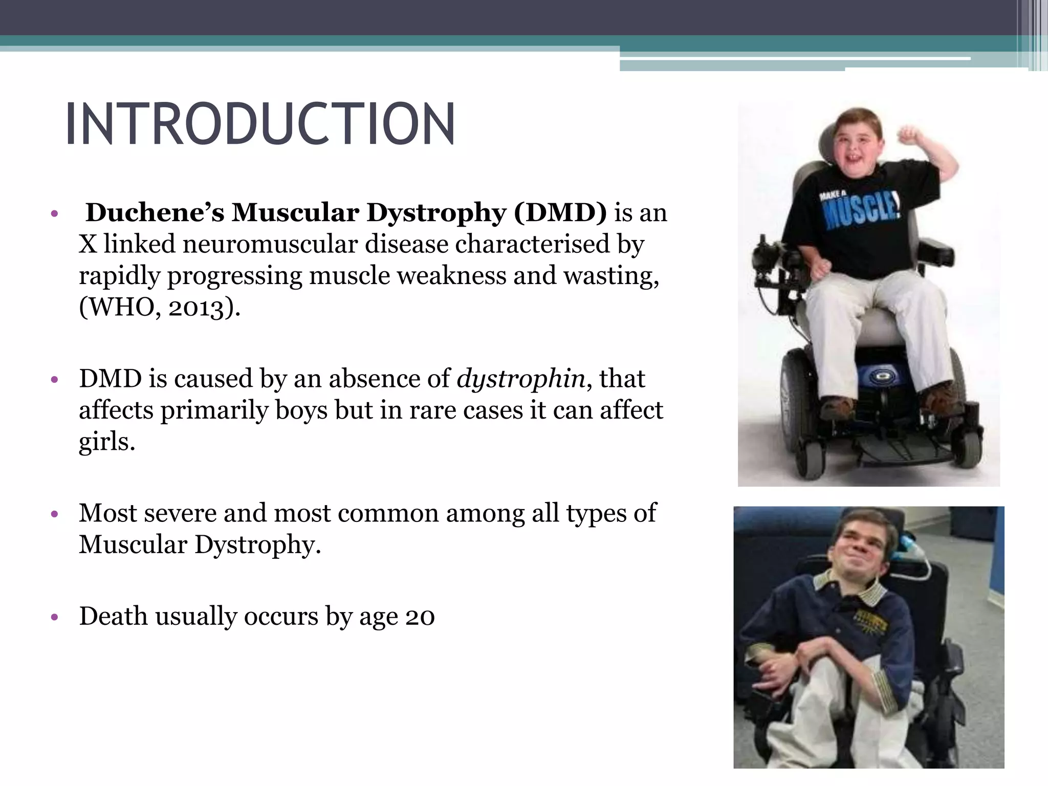 Duchene’s muscular dystrophy | PPTX