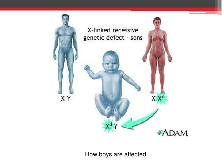 Duchenne Muscular Dystrophy