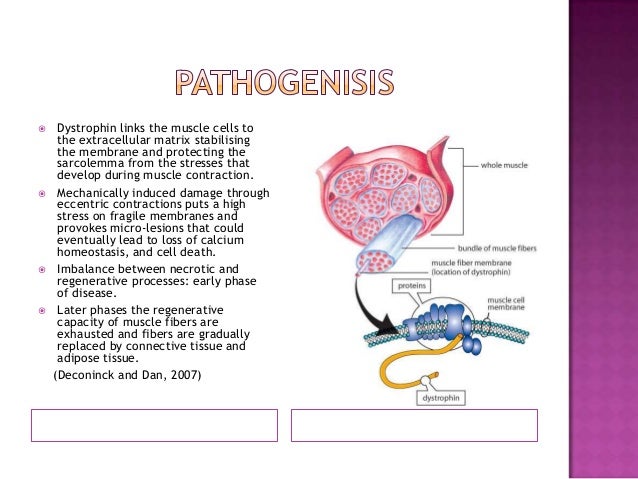 Duchenne muscular dystrophy