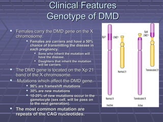 Duchenne muscular dystrophy | PPT
