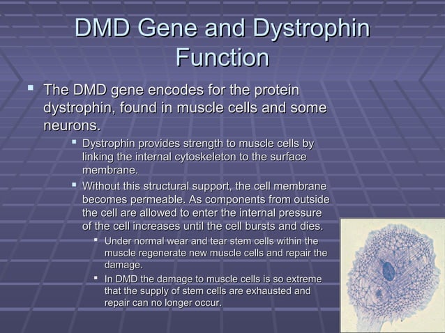 Duchenne muscular dystrophy | PPT
