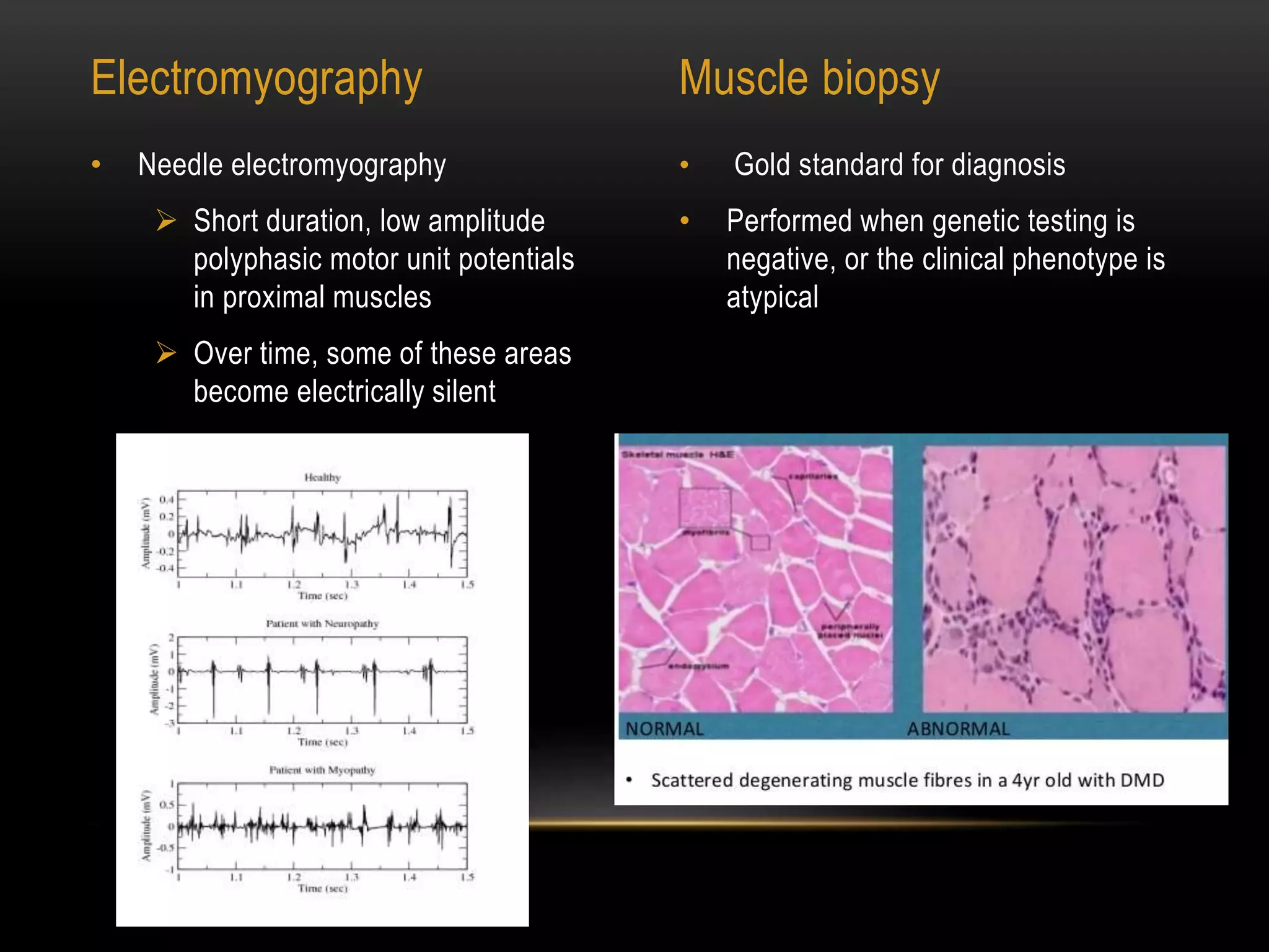 Duchenne muscular dystrophy | PPTX