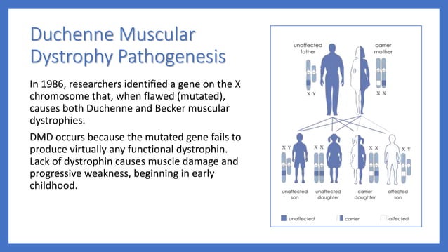 Duchenne Muscular Dystrophy | PPTX | Physical Therapy | Wellness