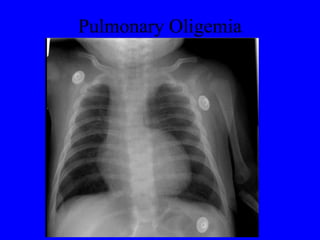 Duct dependent circulation.ppt2