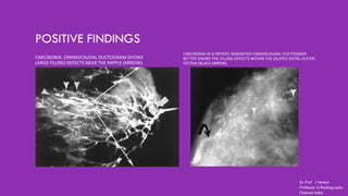 Ductography by prof j venkat | PDF