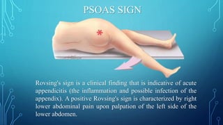 Seminar Presentation On Appendicitis Pptx