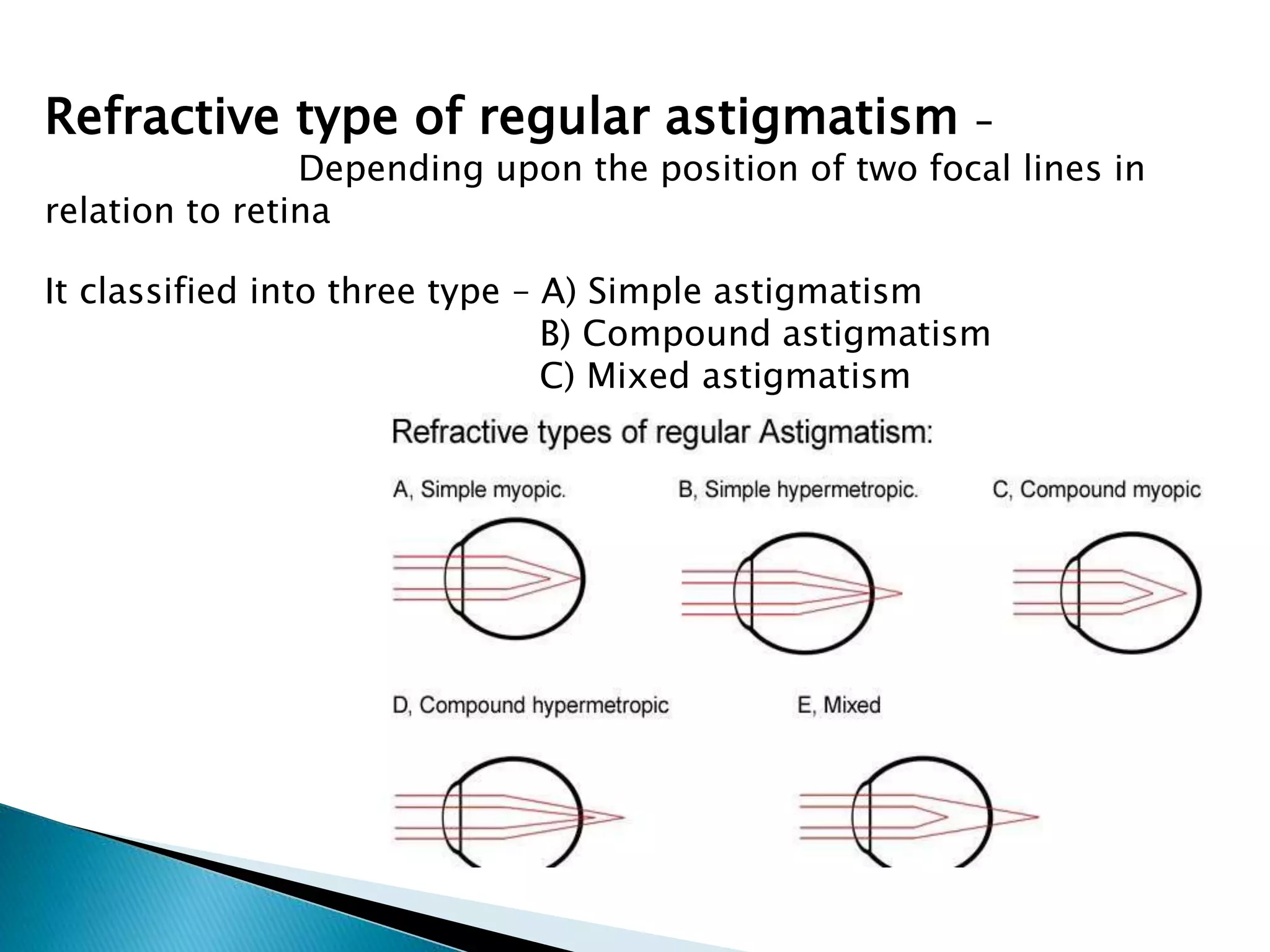 Astigmatism | PPTX
