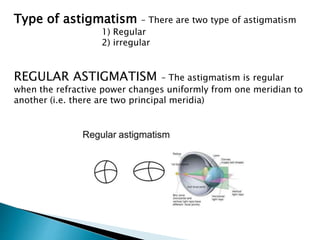 Astigmatism | PPTX | Eye and Vision Conditions | Diseases and Conditions