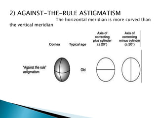 Astigmatism | PPTX