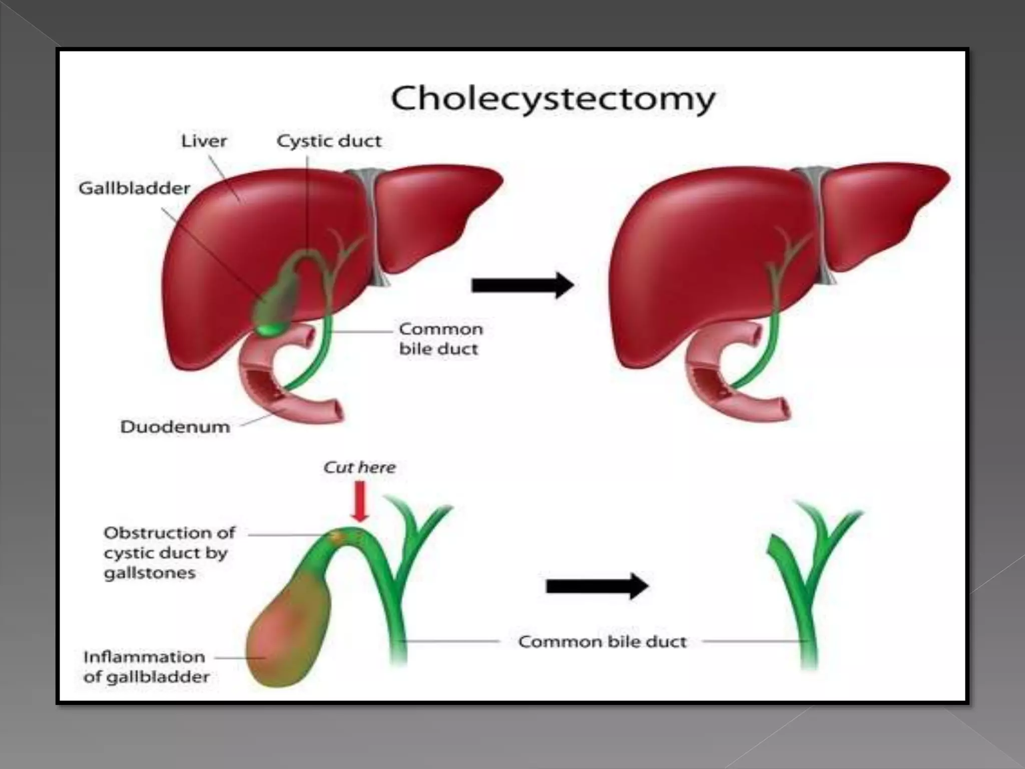 Hepatobiliary System (Part 2) | PPTX