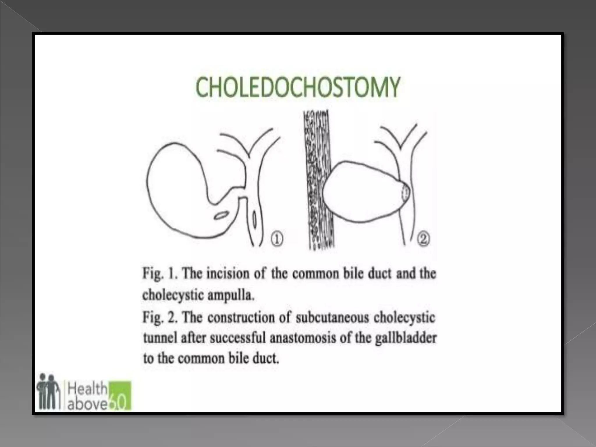 Hepatobiliary System (Part 2) | PPTX