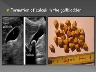 Hepatobiliary System (Part 2) | PPTX