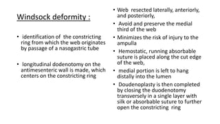 Duodenal atresia | PPTX