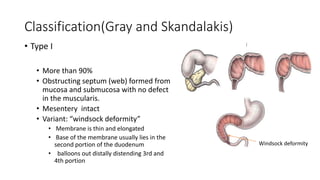 Duodenal atresia | PPTX