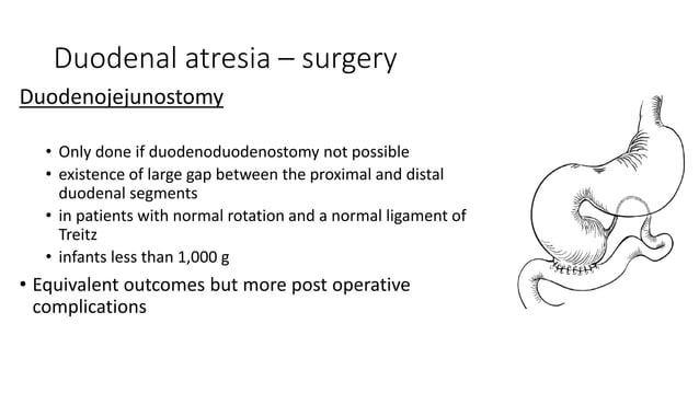Duodenal Atresia
