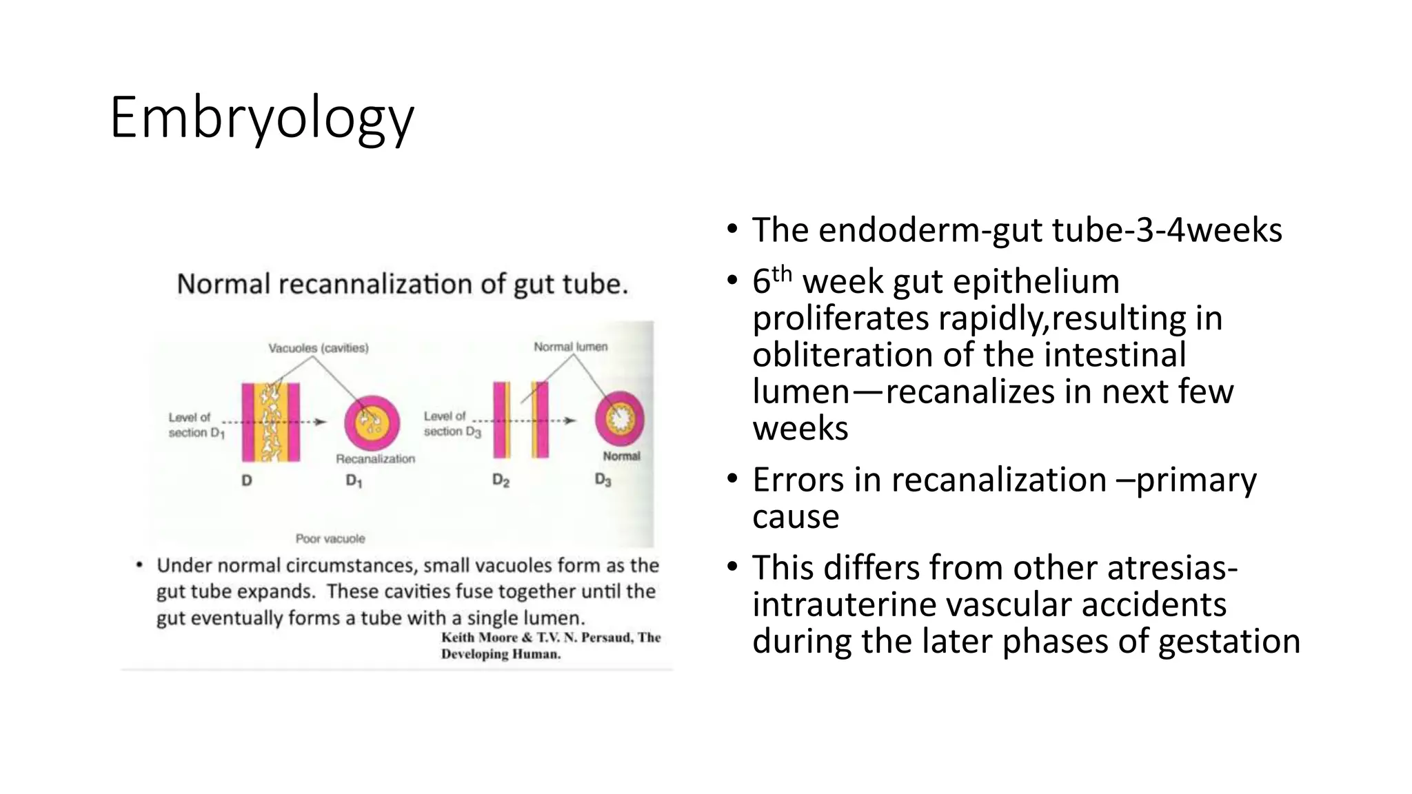 DUODENAL ATRESIA.pptx