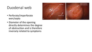 DUODENAL ATRESIA.pptx