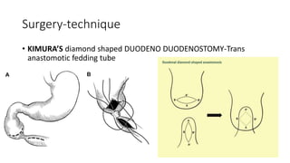 DUODENAL ATRESIA.pptx